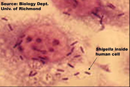 Overview — Shigella Dysenteria Bacterium — Biological — Nuclear ...
